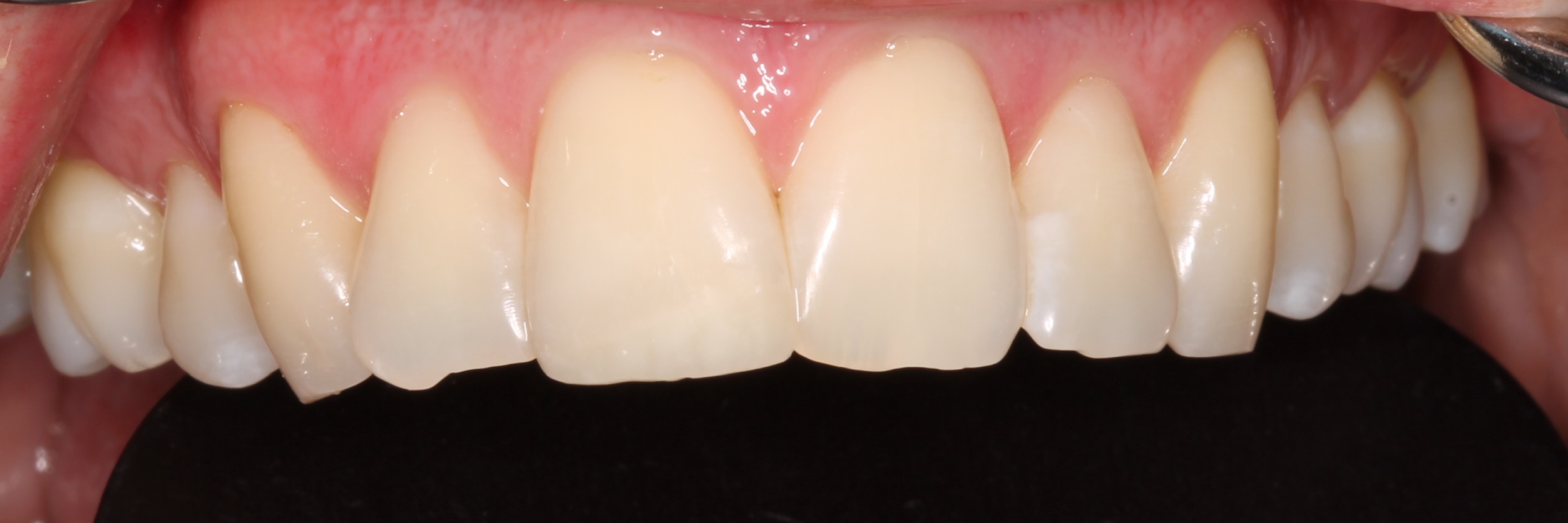 gallery - hornseydentalcentre